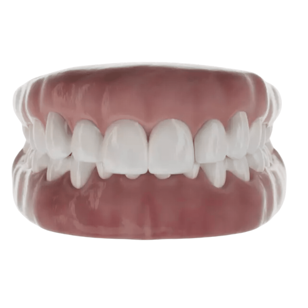 Aligneurs dentaires invisibles : comment ça marche