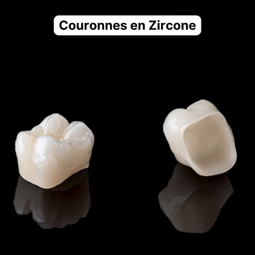 Les Couronnes Dentaires : Tout ce que Vous Devez Savoir - Paris Dental ...